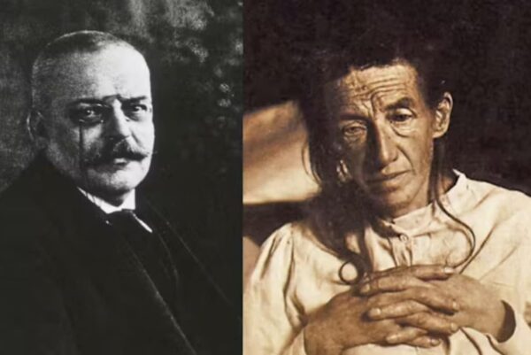 A Neurologist's History of First Known Alzheimer’s Patient Auguste ...